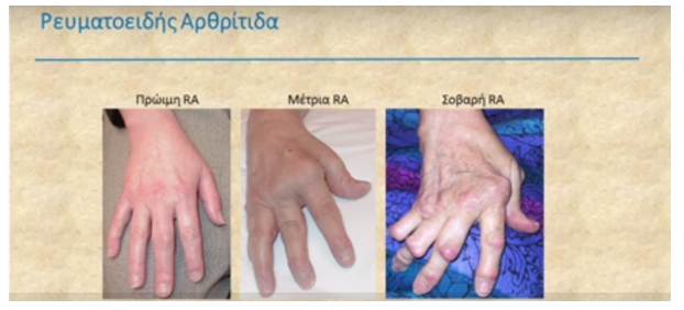 ΤΙ ΕΙΝΑΙ Ο ΡΕΥΜΑΤΟΛΟΓΟΣ - ΤΣΙΑΝΤΟΥΛΑ ΕΥΑΓΓΕΛΙΑ